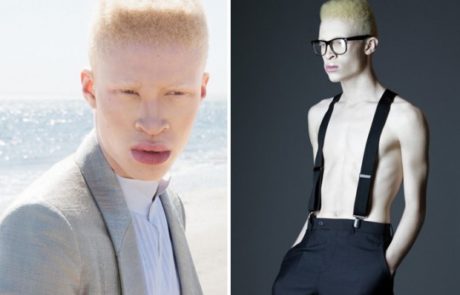 Top 10 Unique Fashion Models | Unique Models Break Modeling Barriers