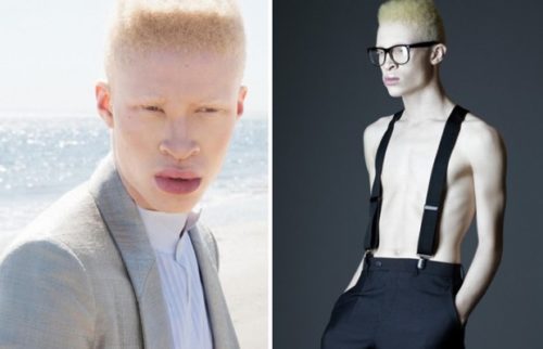 Top 10 Unique Fashion Models | Unique Models Break Modeling Barriers